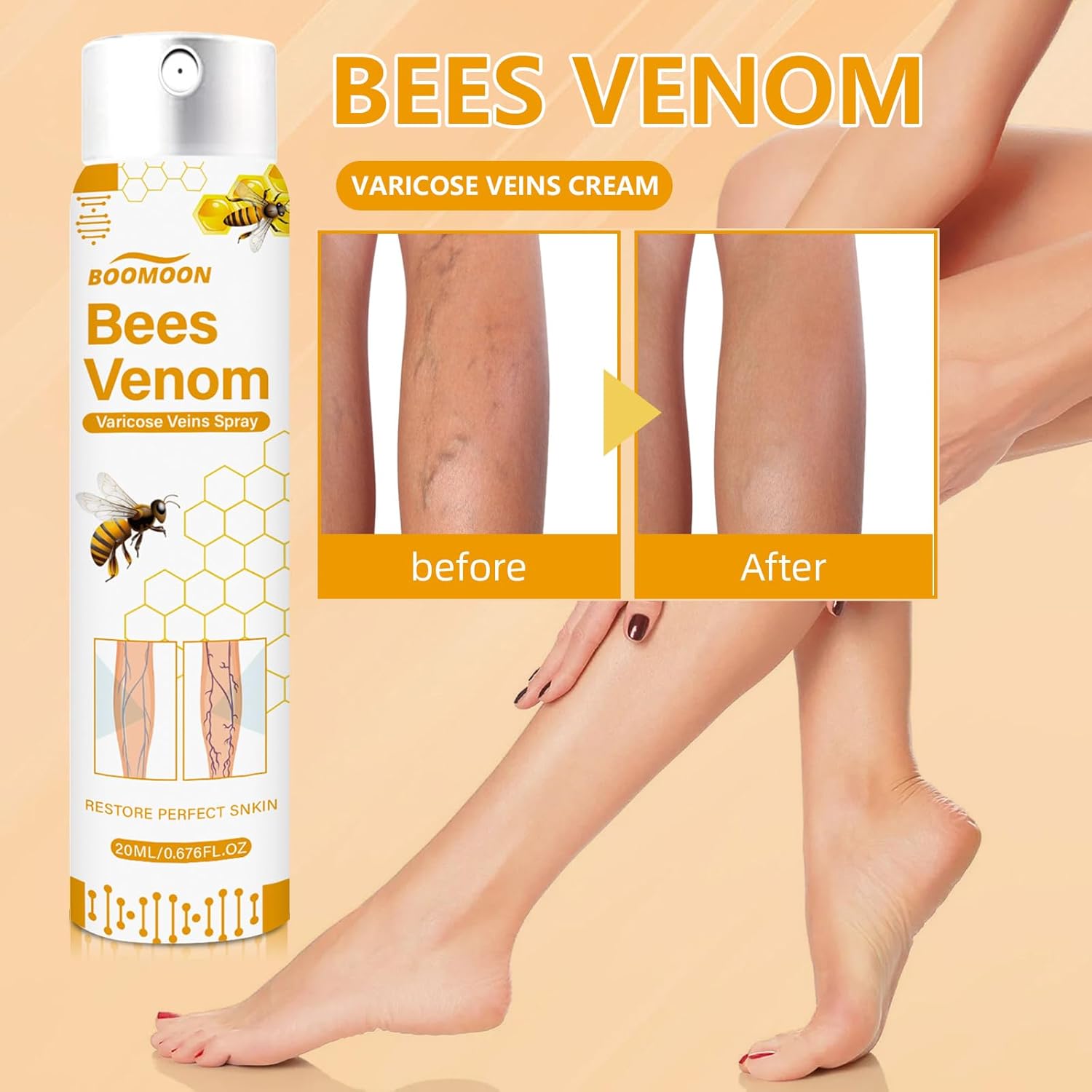 Bee Venom Varicose Veins Spray – Zaavio
